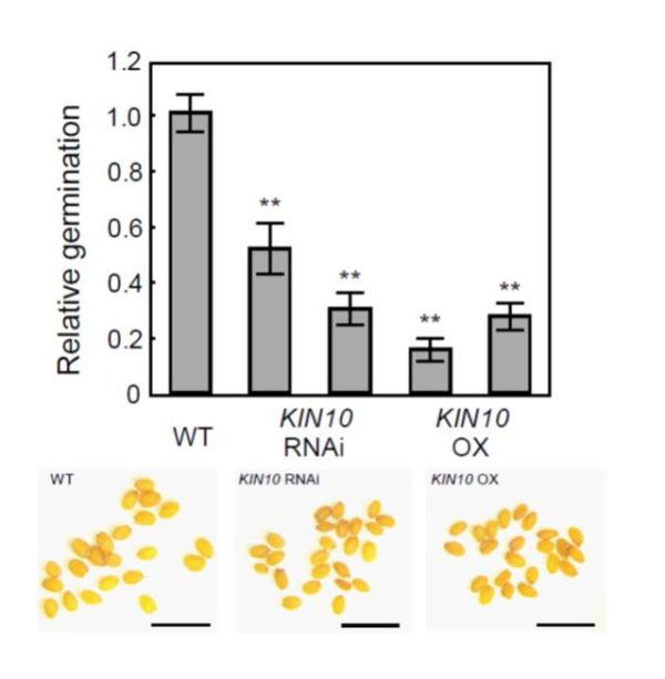 A Kinase- and Proteasome-Mediated Link Between Lipid Biosynthesis and ...