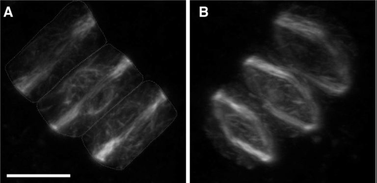 The preprophase band of microtubules controls the robustness of ...