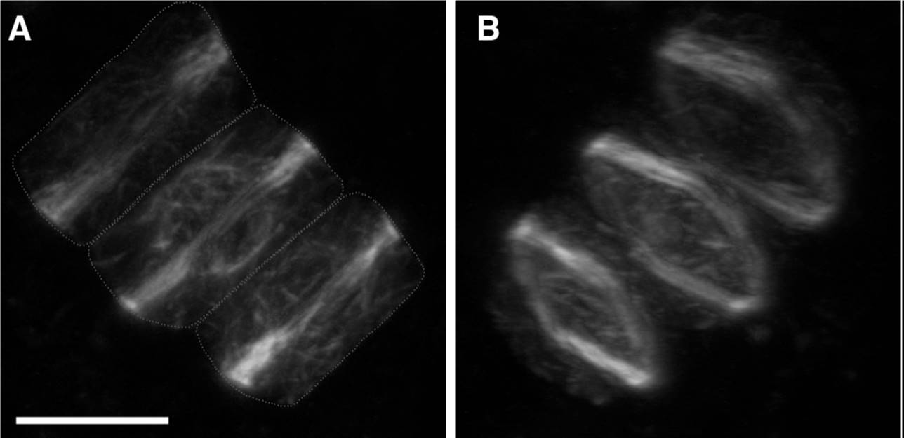The preprophase band of microtubules controls the robustness of ...