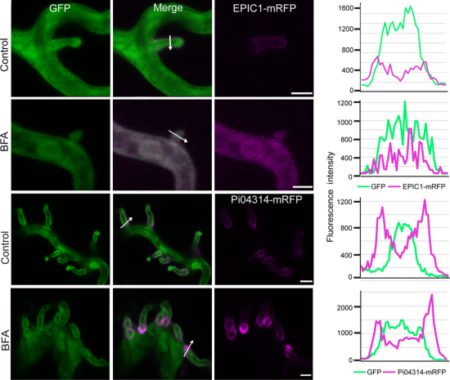 Special delivery: An independent secretion pathway for the delivery of ...