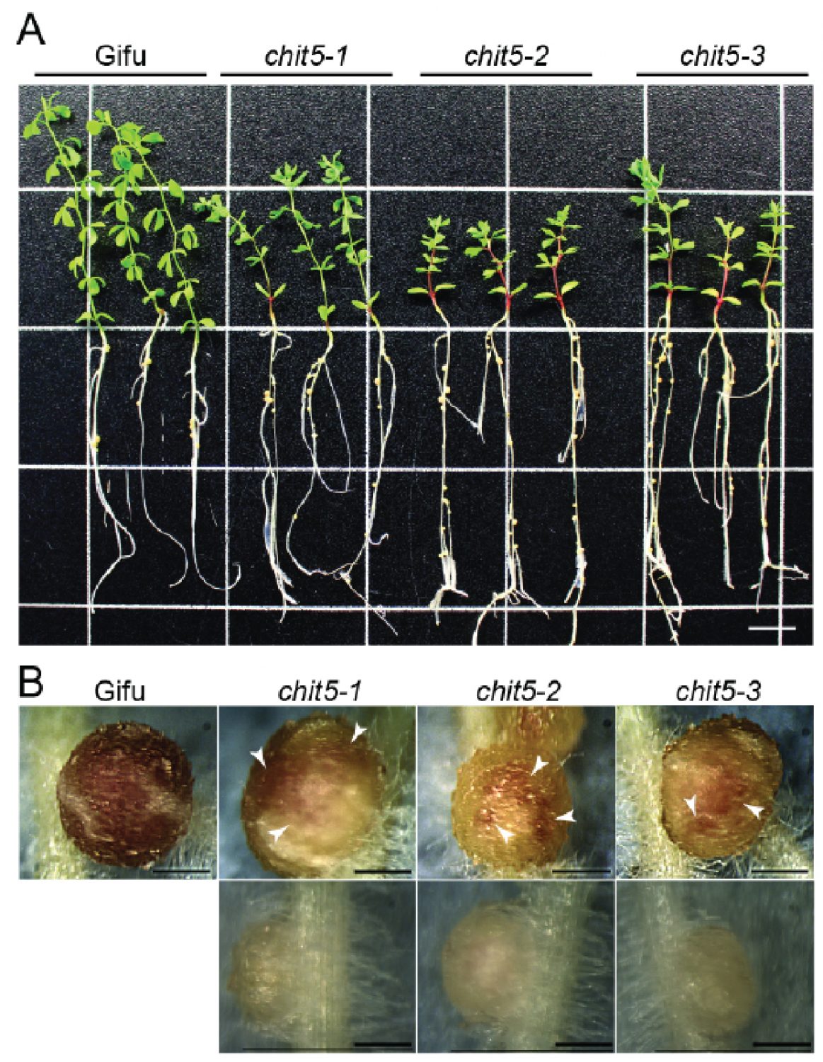 A plant chitinase controls cortical infection thread progression and ...
