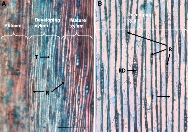 Ray Parenchymal Cells Contribute to Lignification | Plantae