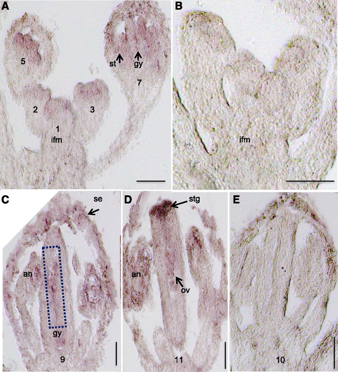 Role of Cell Wall Invertase in Ovule Development | Plantae
