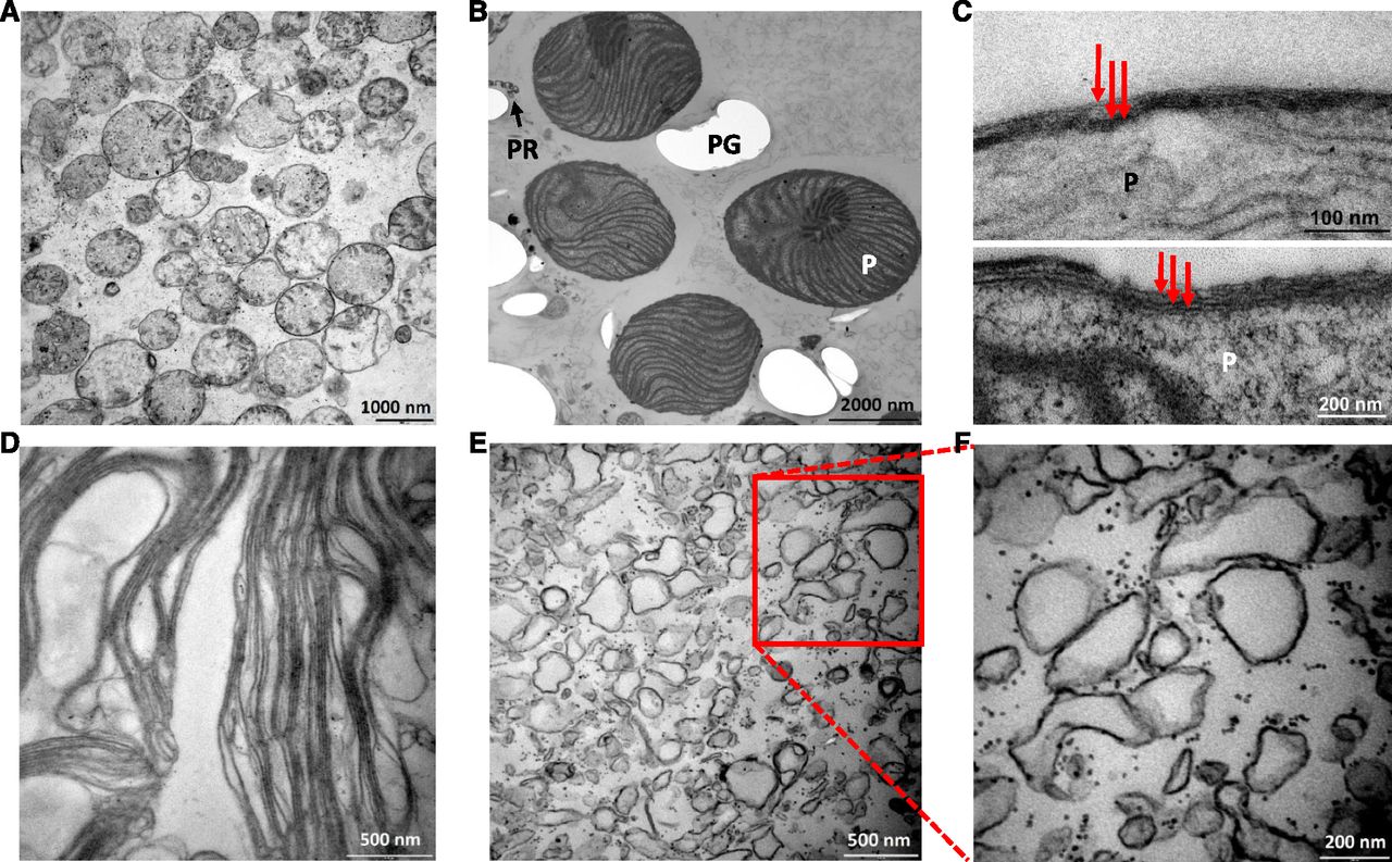 On the Inside: The Origins of Euglena gracilis’s Middle Plastid ...